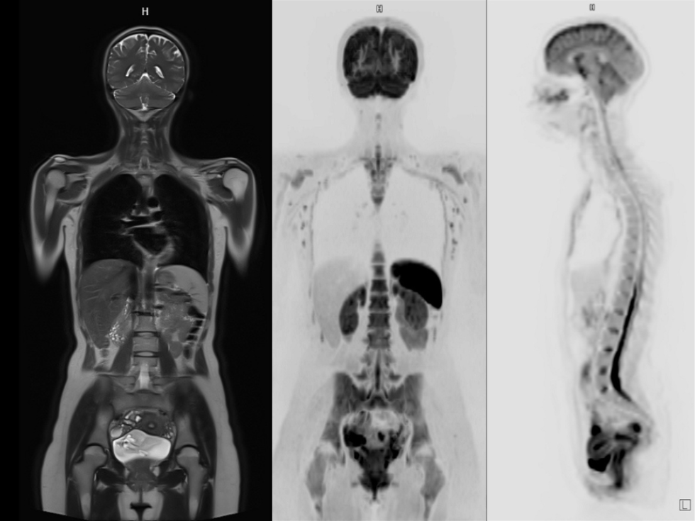 MAGNETNA REZONANCA CELOG TELA - DC Merkur
